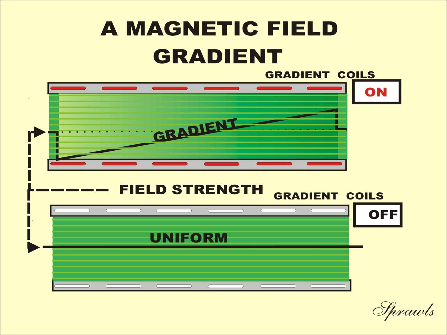 Magnetic Resonance Imaging